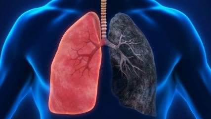 A tuberculose (TBC) apesar de antiga, não é passado. Anualmente, apesar ...